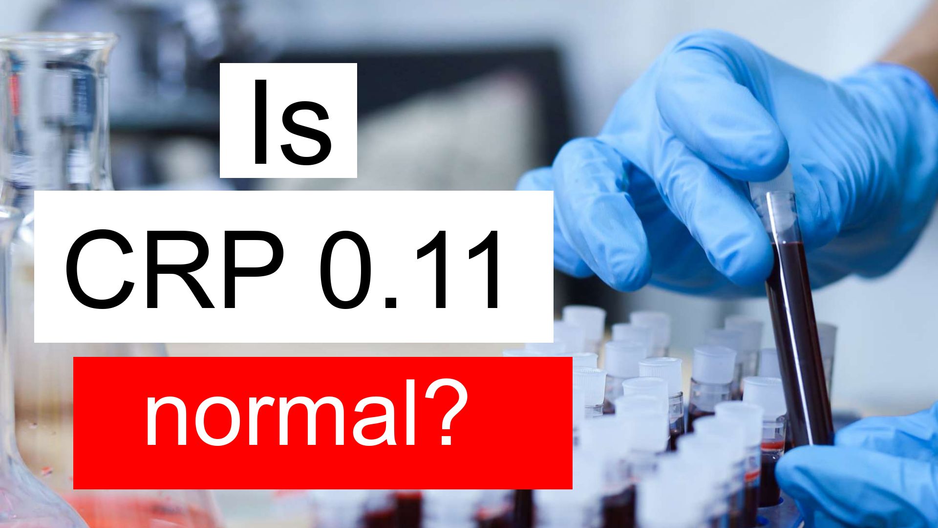 Is CRP 0 11 Normal High Or Low What Does C Reactive Protein Level 0 Is CRP 0 11 Normal High Or Low What Does C Reactive Protein Level 0