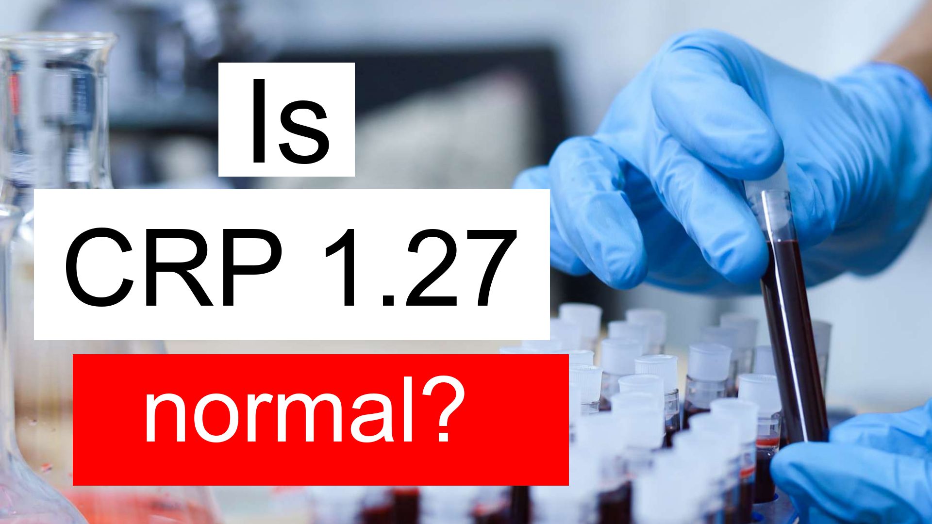 Is CRP 1 27 Normal High Or Low What Does C Reactive Protein Level 1 Is CRP 1 27 Normal High Or Low What Does C Reactive Protein Level 1