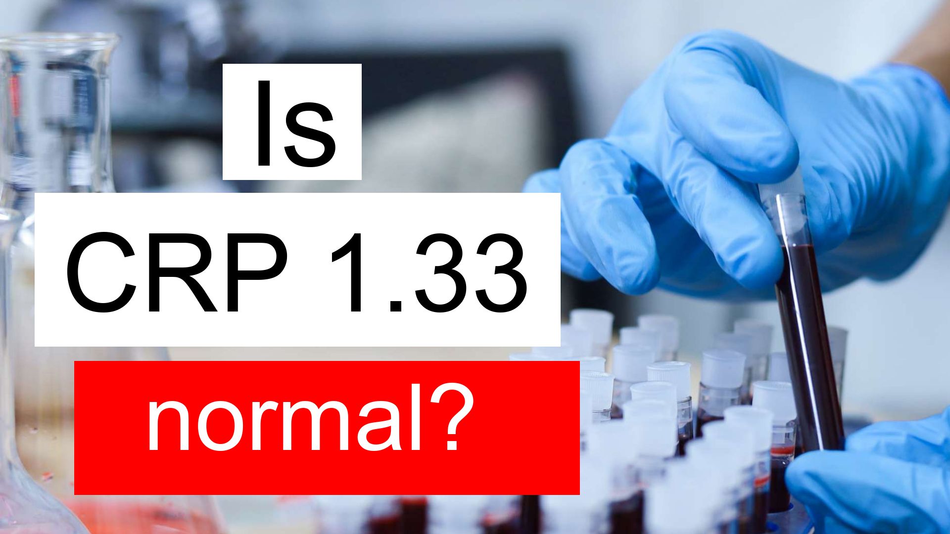 Is CRP 1 33 Normal High Or Low What Does C Reactive Protein Level 1 Is CRP 1 33 Normal High Or Low What Does C Reactive Protein Level 1