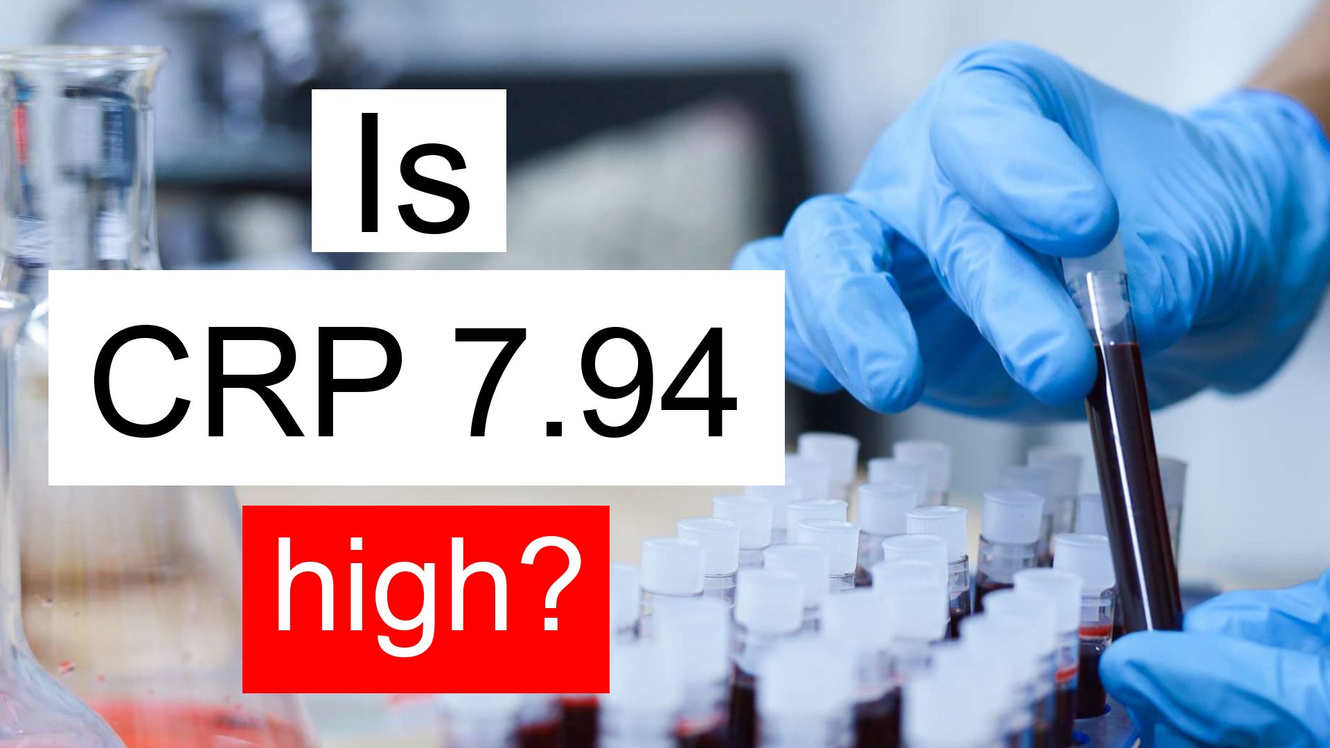 Is CRP 7 94 High Normal Or Dangerous What Does C Reactive Protein is-crp-7-94-high-normal-or-dangerous-what-does-c-reactive-protein