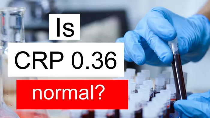 Is CRP 0 36 Normal High Or Low What Does C Reactive Protein Level 0 