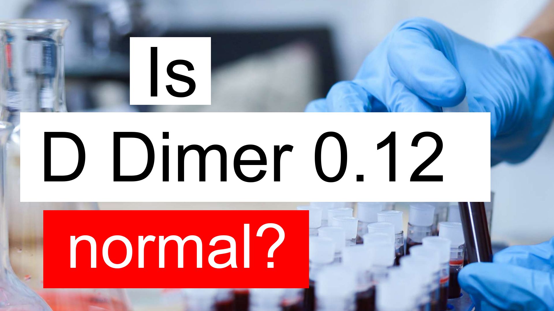 D Dimer 0.12 ug/mL: Symptoms you should not ignore