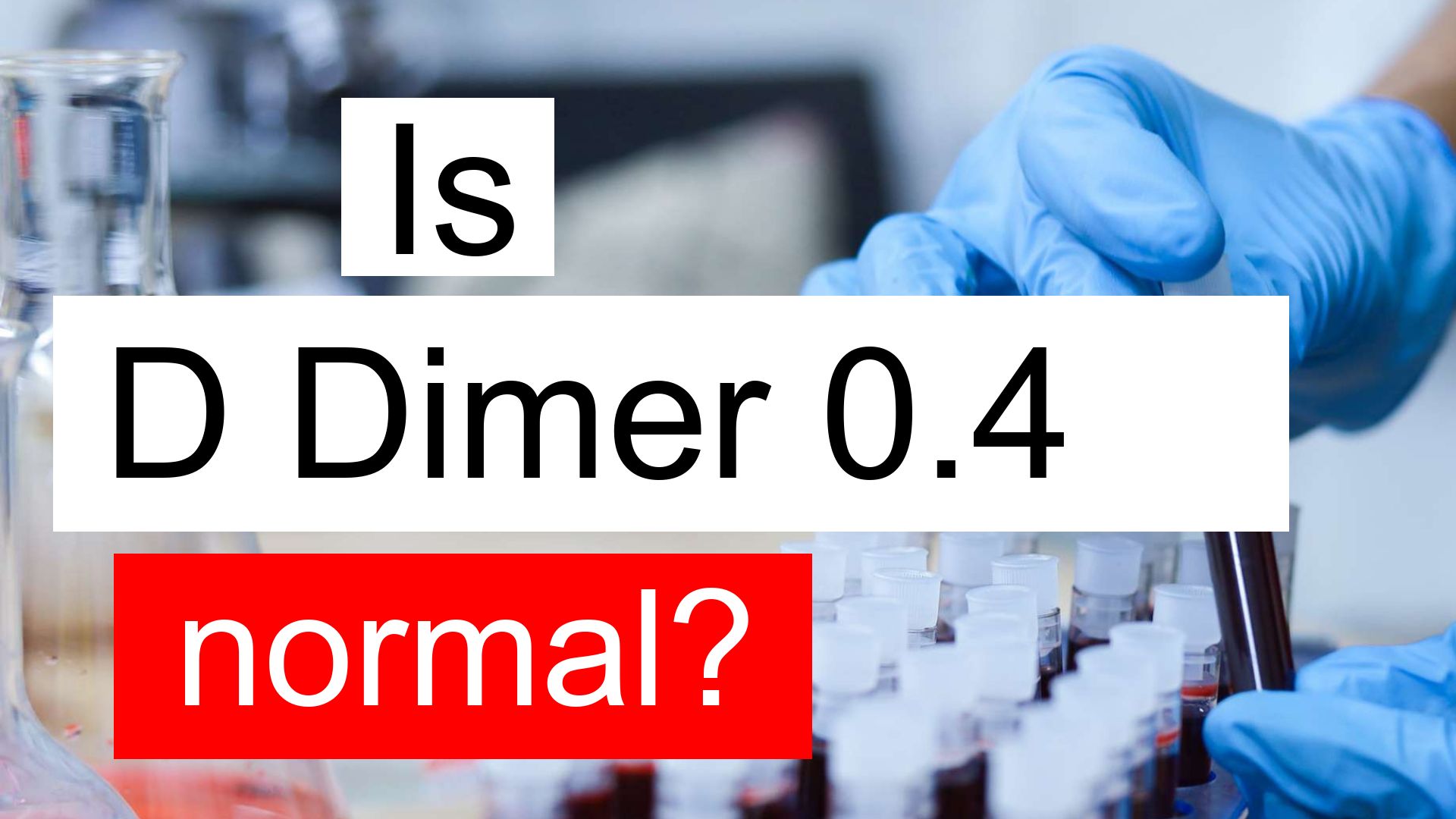 D Dimer 0.4 ug/mL: Symptoms you should not ignore