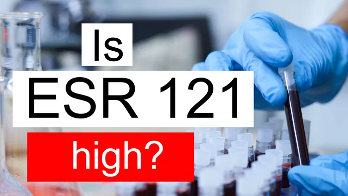 Is ESR 121 high, normal or dangerous? What does ESR level 121 mean?