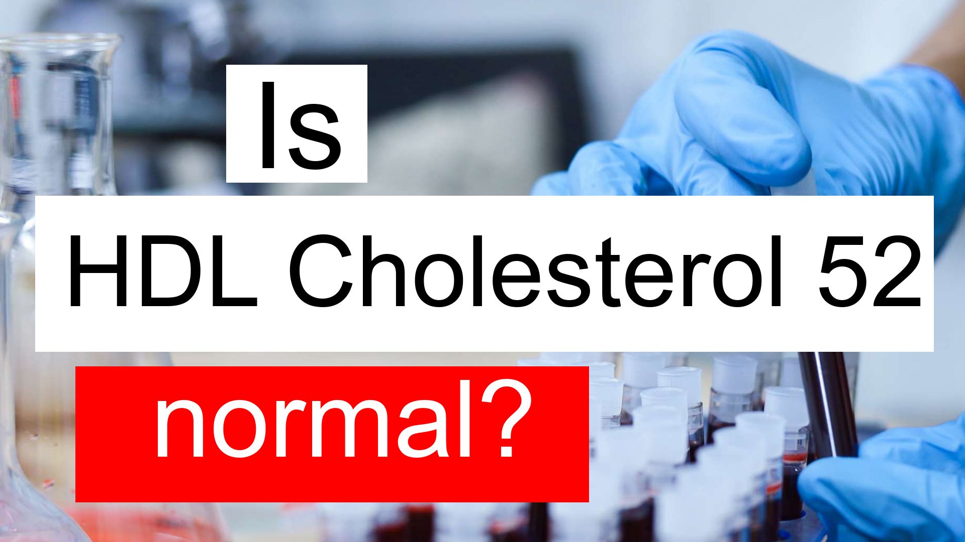 Is HDL cholesterol 52 normal, high or low? What does HDL cholesterol ...