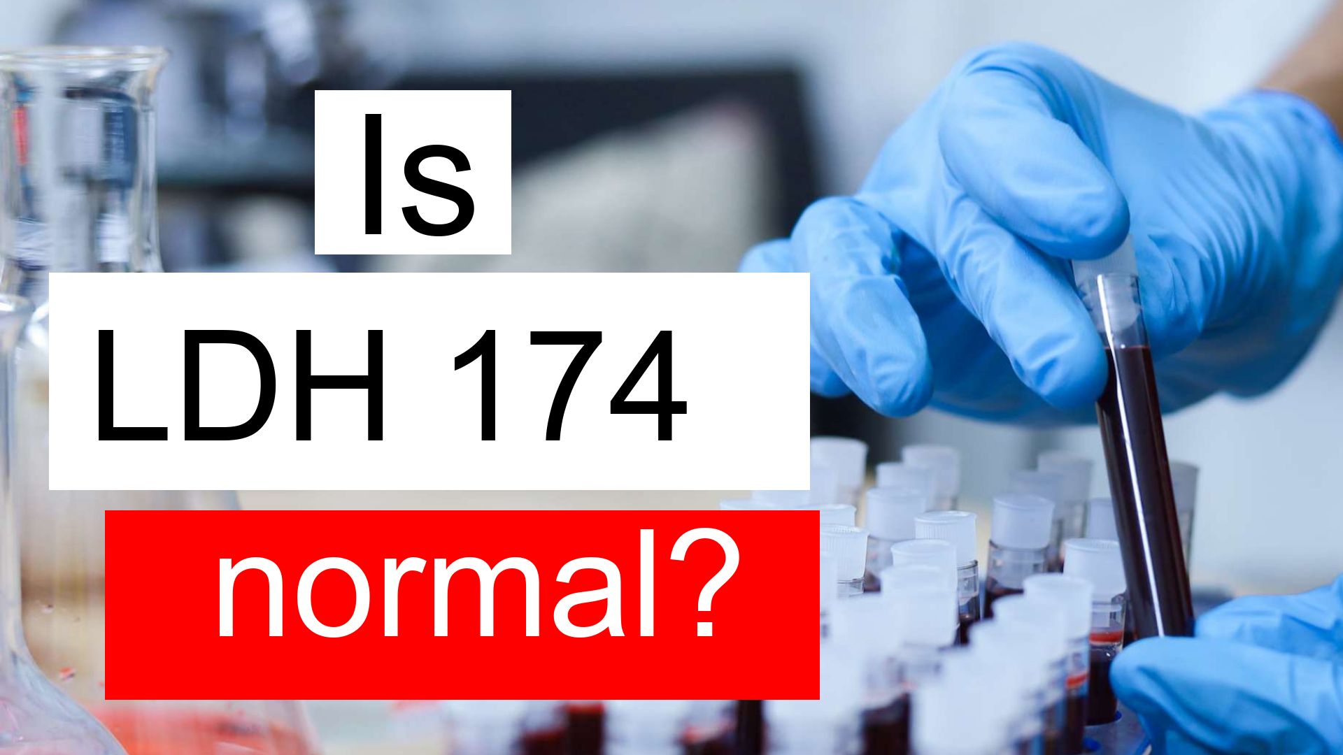 Is LDH 174 normal, high or low? What does Lactate dehydrogenase level ...