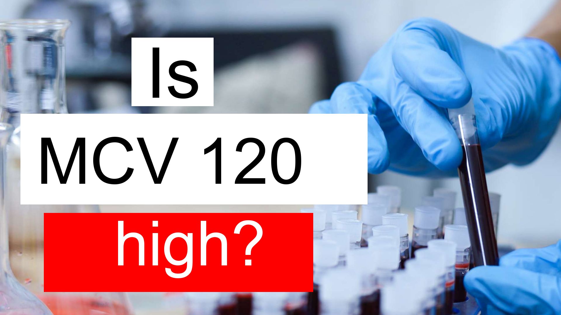 Is MCV 120 high, normal or dangerous? What does Mean corpuscular volume ...