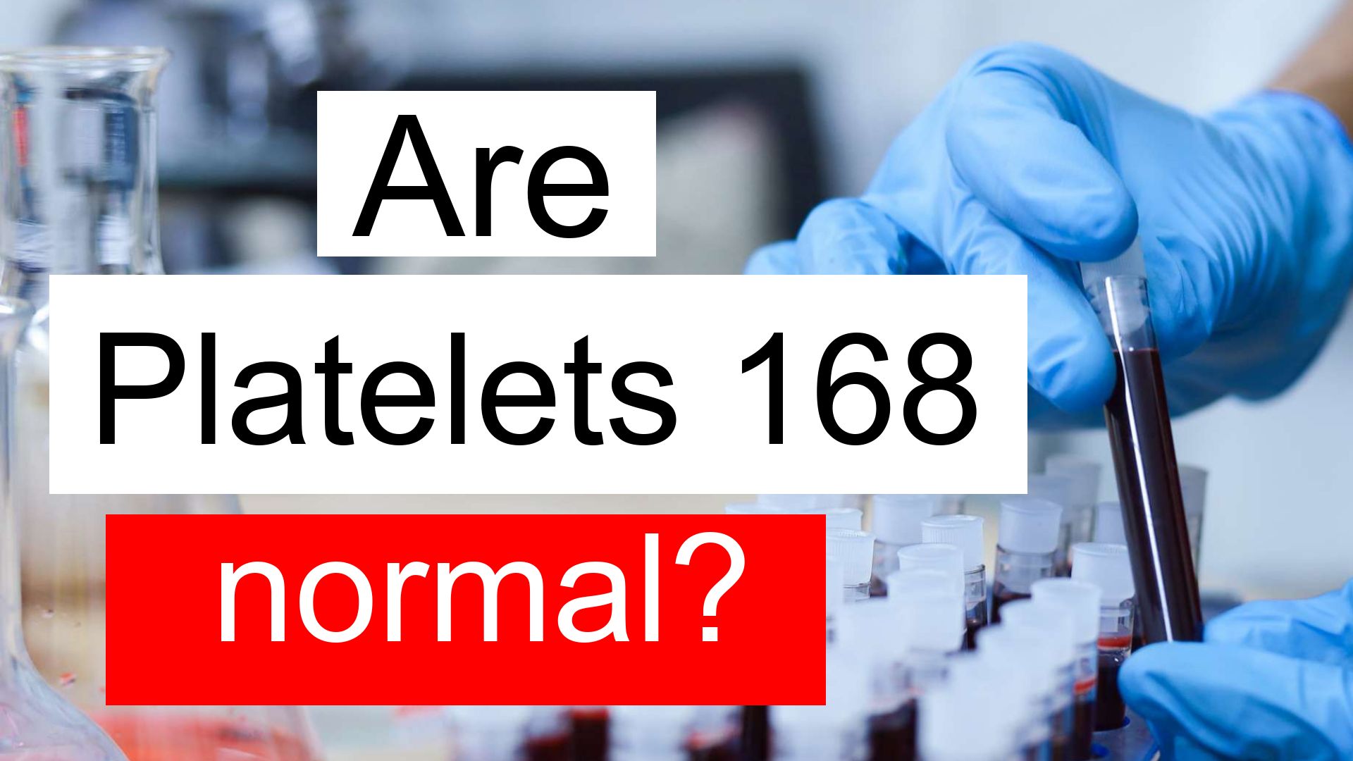 Is Platelet count 168 normal, high or low? What does Platelet count ...