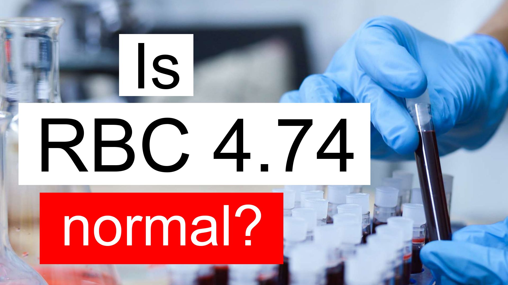 Is RBC 4 74 Normal High Or Low What Does Red Blood Cell Count Level 4 Is RBC 4 74 Normal High Or Low What Does Red Blood Cell Count Level 4
