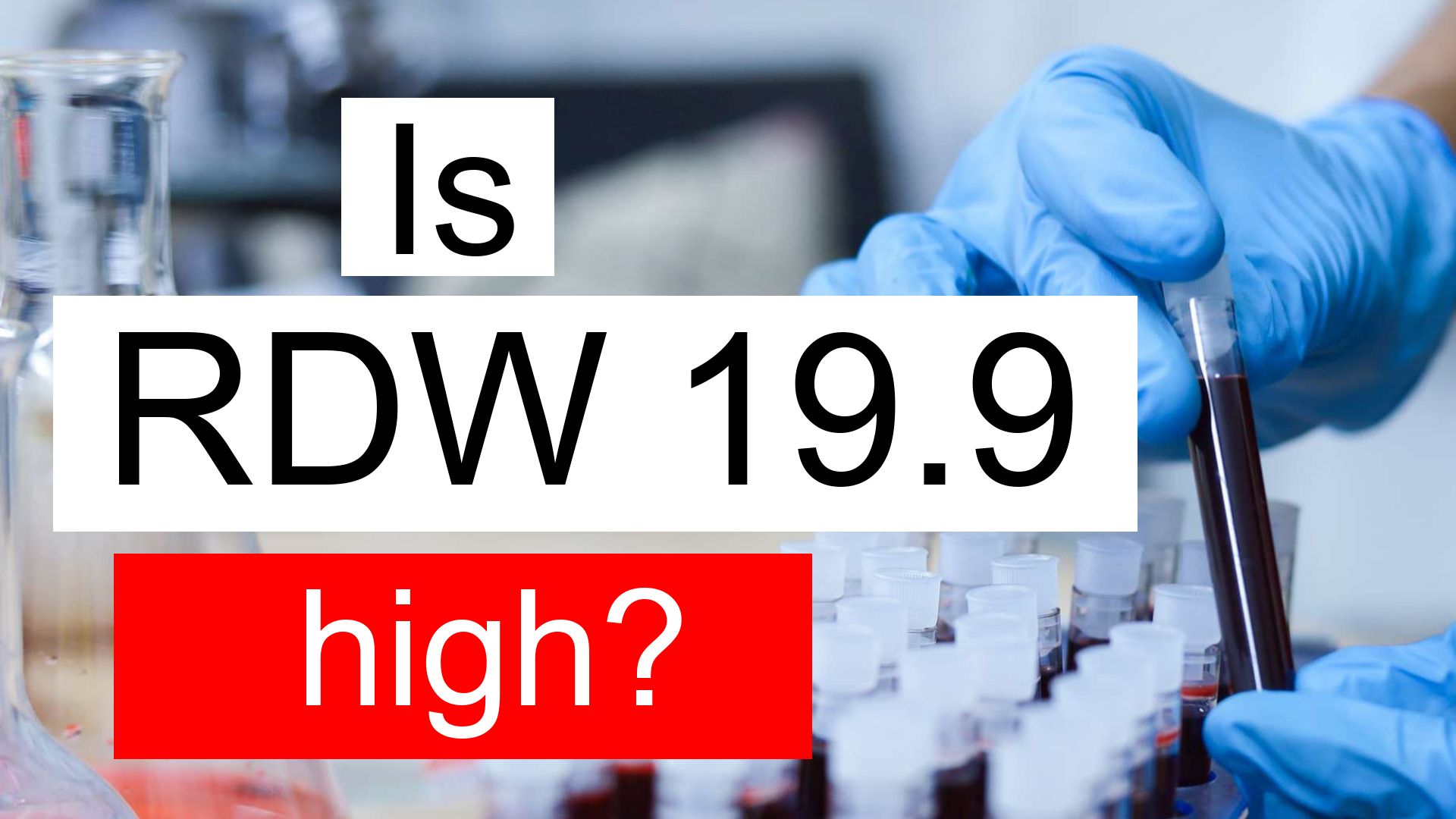 Is RDW 19.9 high, normal or dangerous? What does Red cell distribution ...