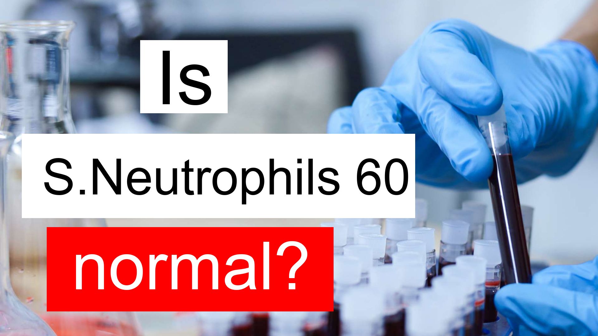 Is Segmented Neutrophils 60 normal, high or low? What does Segmented ...