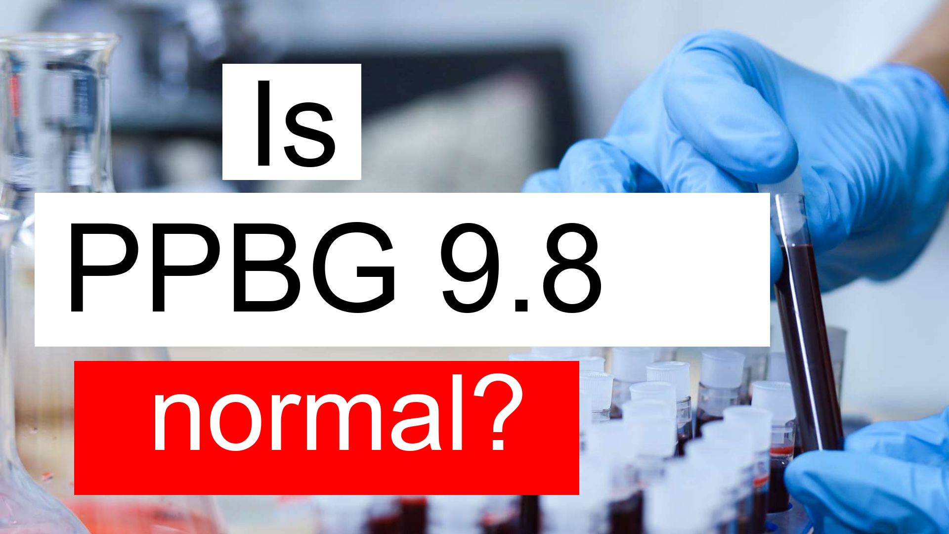 Is Serum PPBG 9.8 high, normal or dangerous? What does Serum PPBG level 9.8 mean?