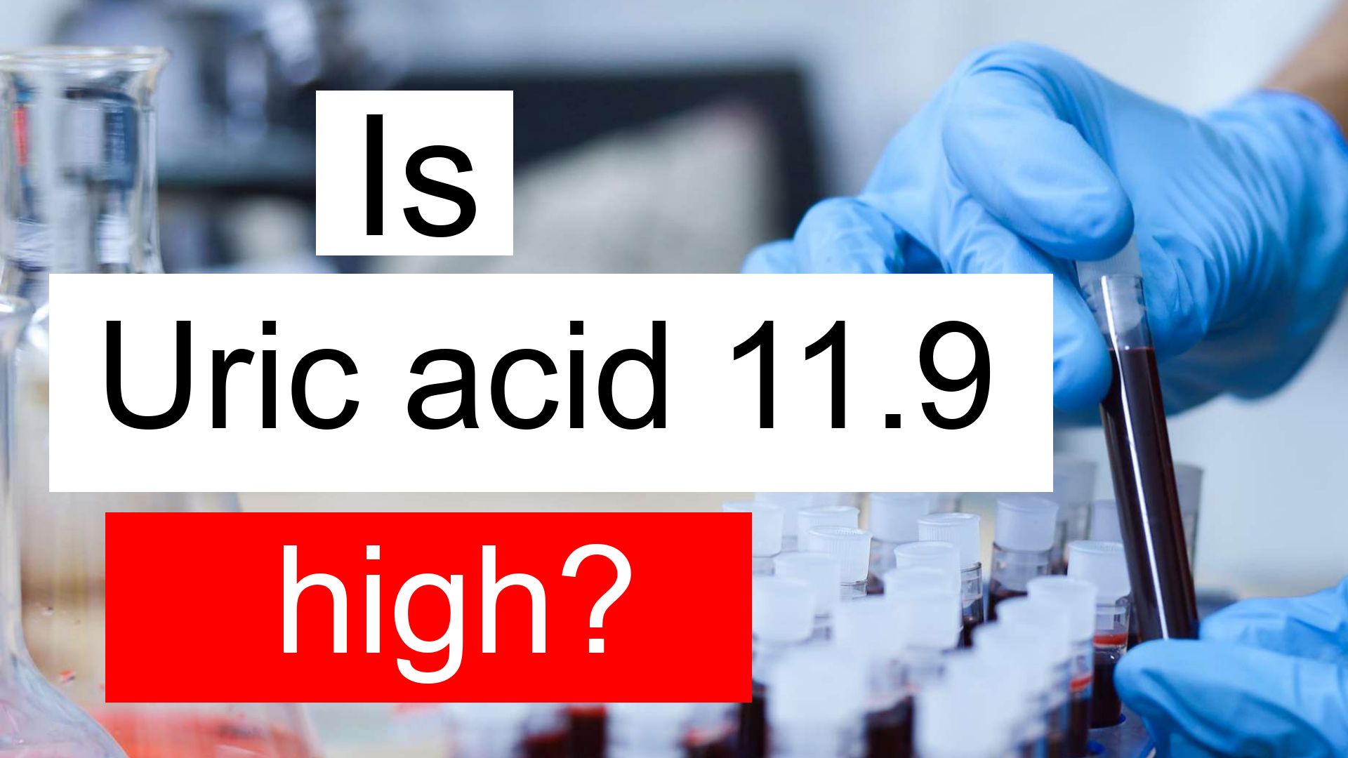 Is Uric acid 11.9 high, normal or dangerous? What does Uric acid level ...