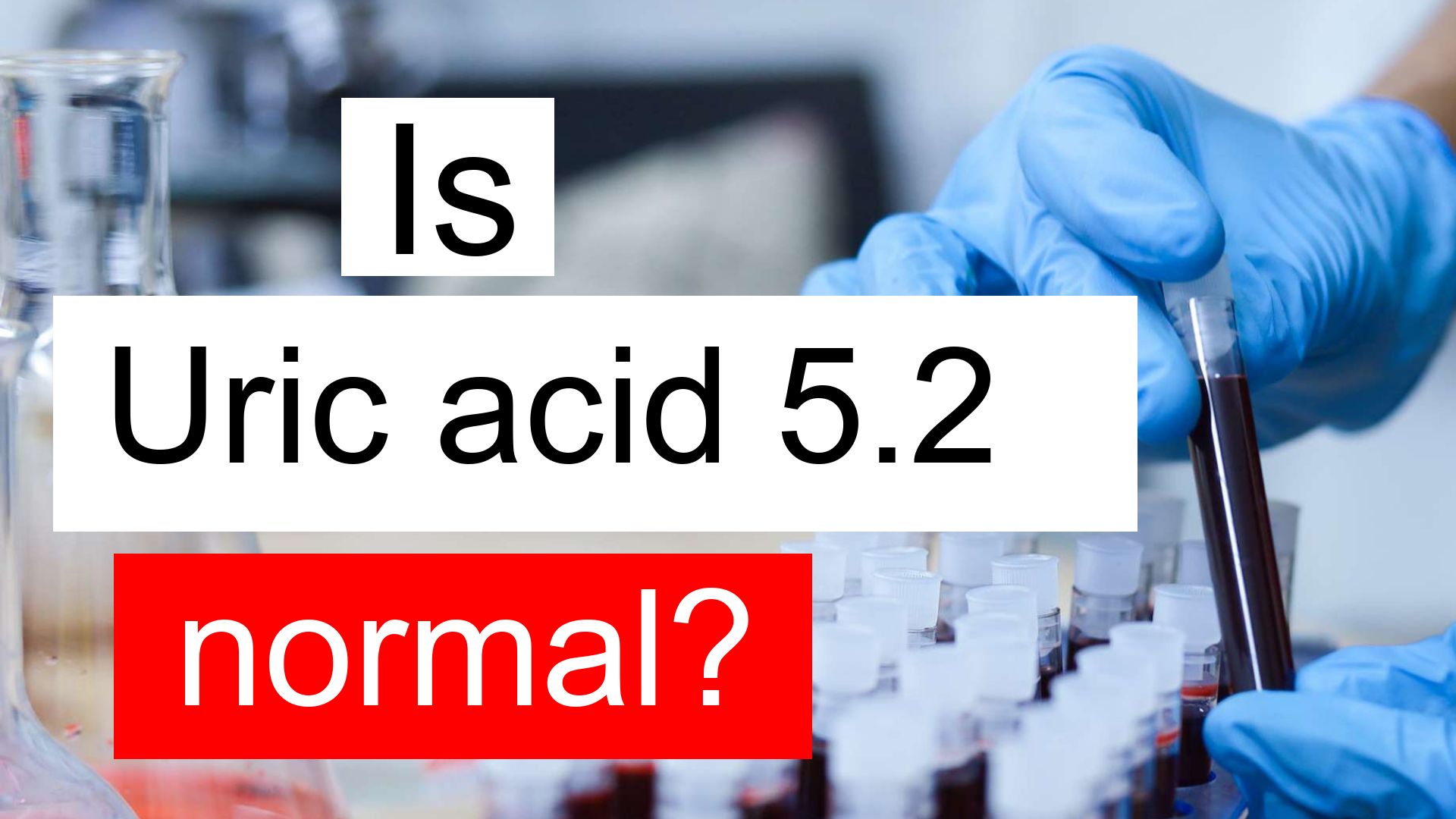 Is Uric acid 5.2 normal, high or low? What does Uric acid level 5.2 mean?