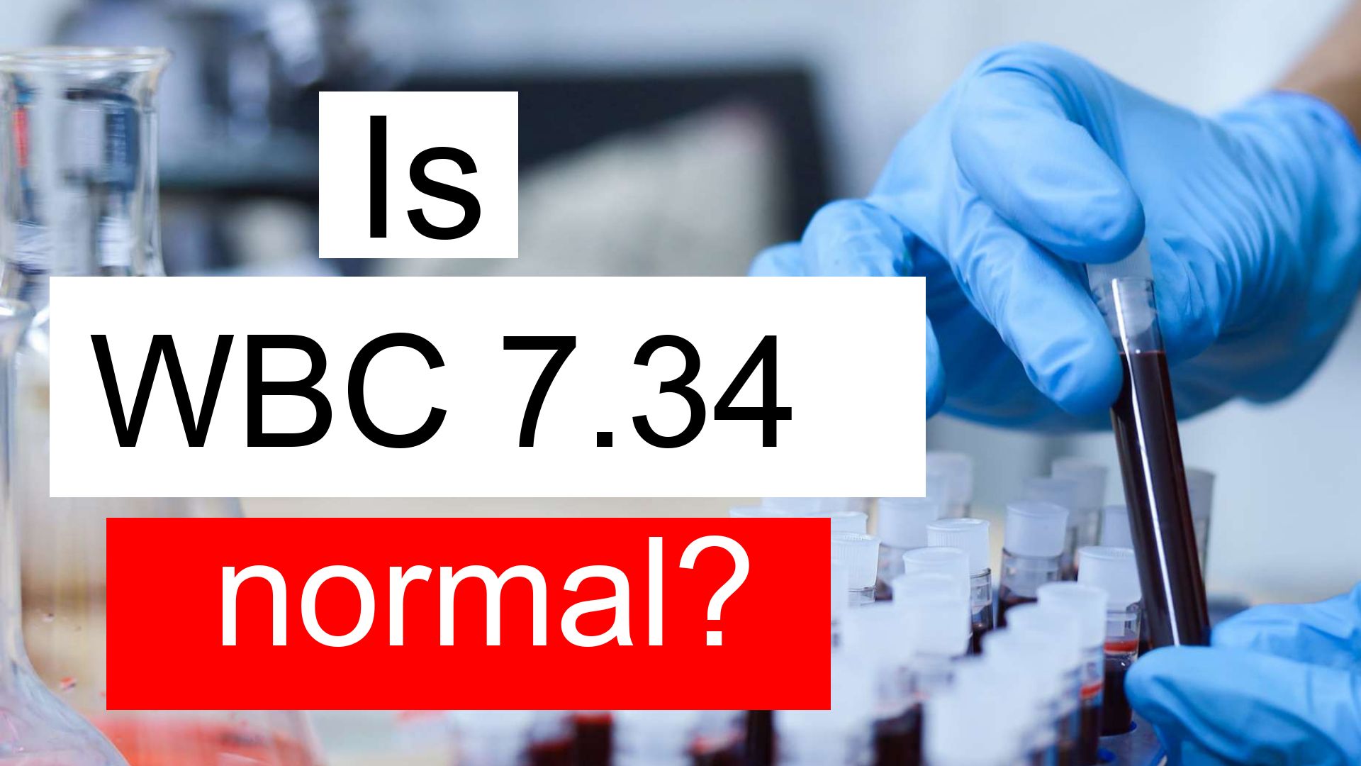 Treatment and symptoms of WBC 7.34 thou/uL | Diet for normal White ...