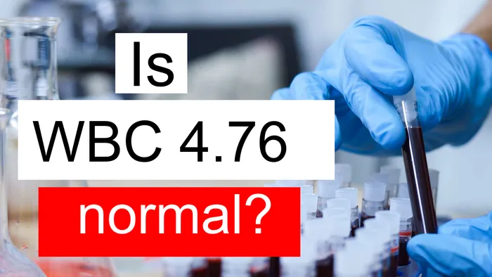 Treatment and symptoms of WBC 4.76 thou/uL | Diet for normal White ...