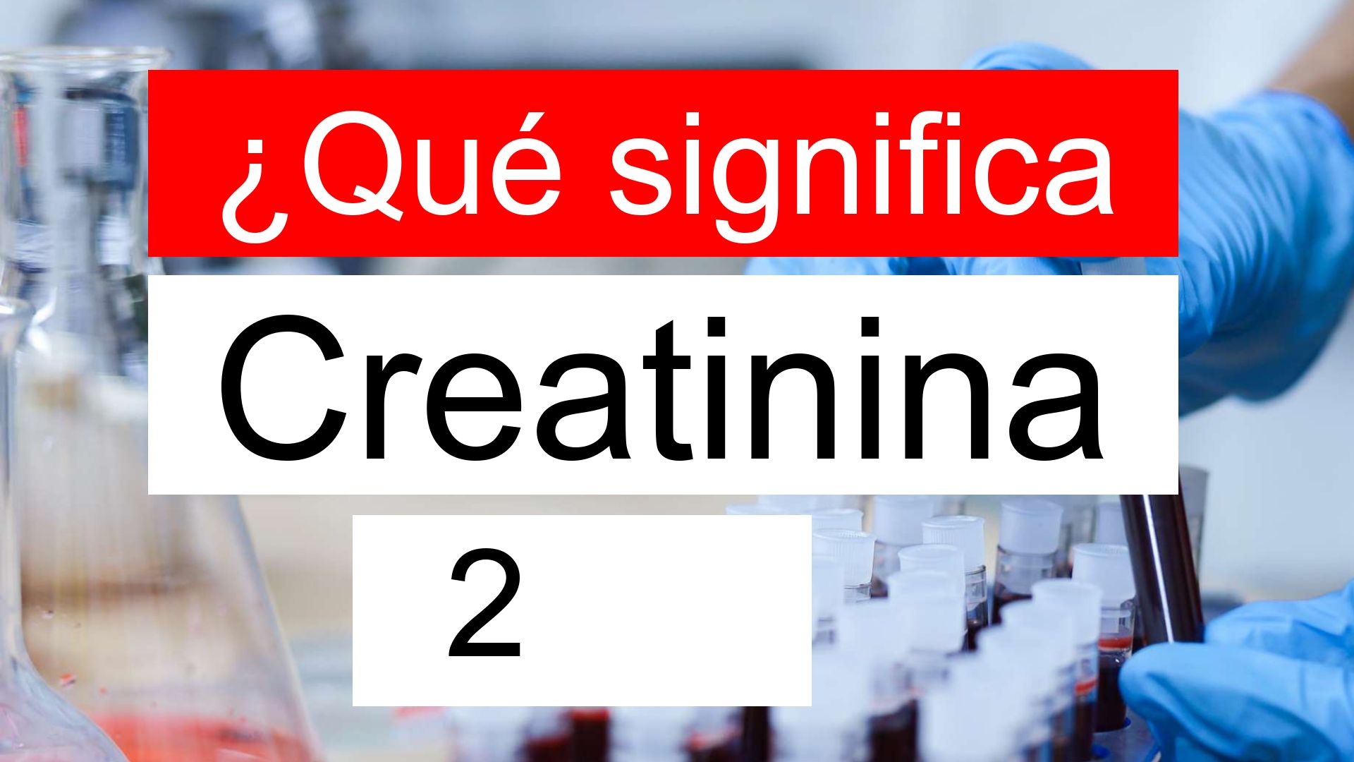 ¿Qué significa Creatinina 2? ¿La Creatinina 2 es alto, normal, o peligrosa?