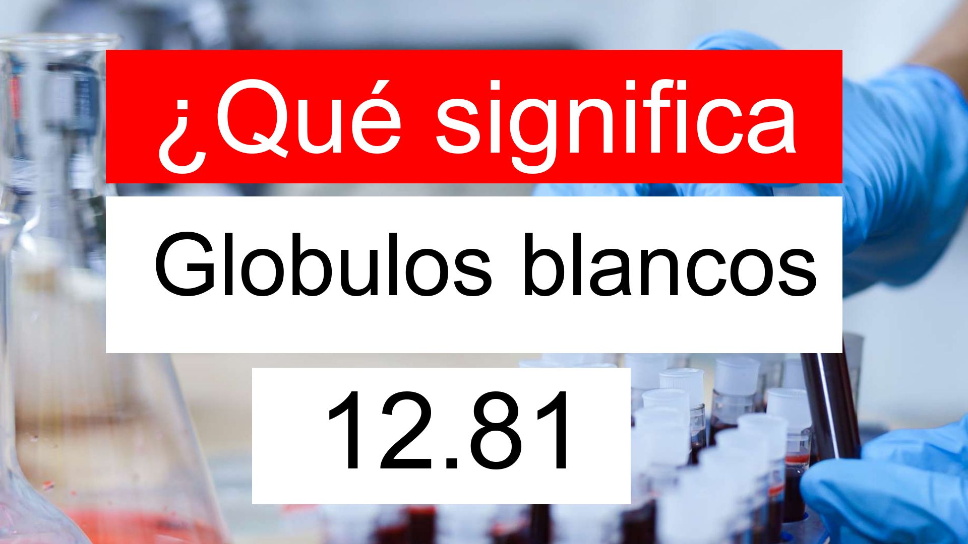 ¿Qué significa Globulos blancos 12.81? ¿La WBC 12,81 es alto, normal, o peligrosa?