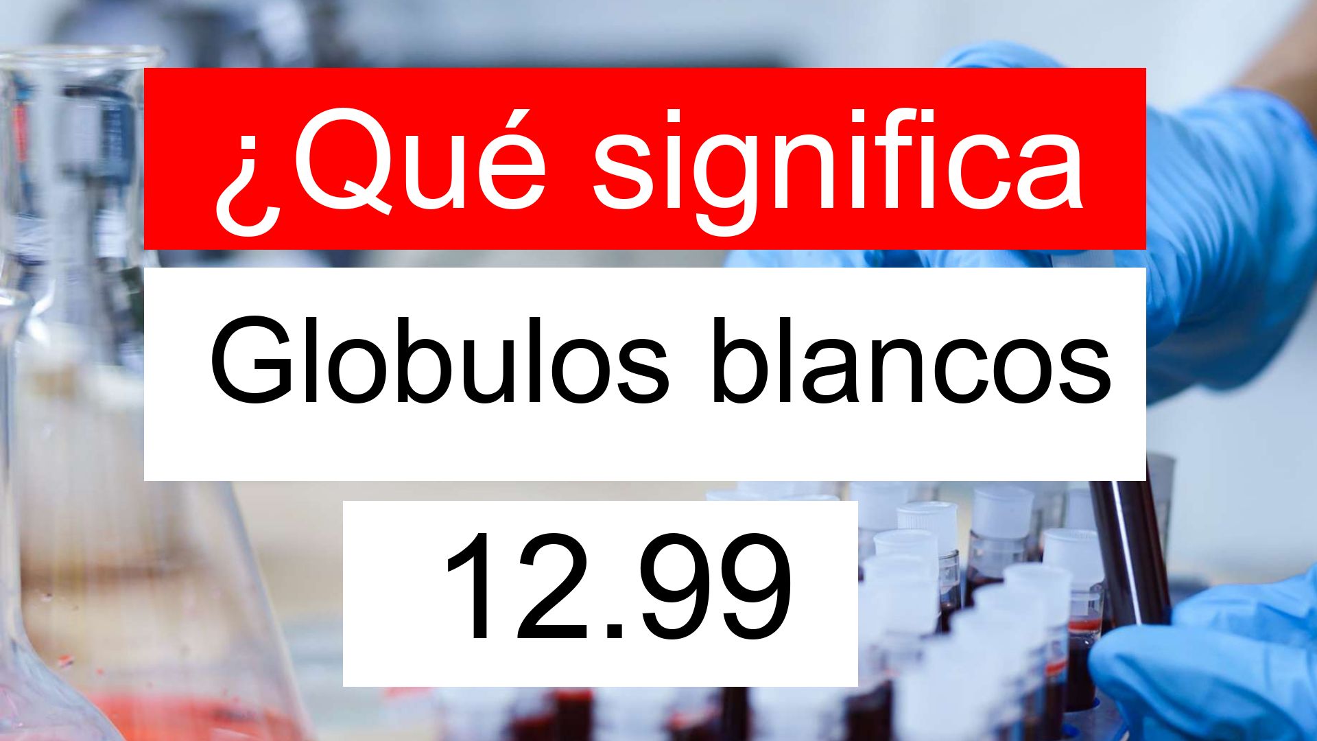 ¿Qué significa Globulos blancos 12.99? ¿La WBC 12,99 es alto, normal, o peligrosa?