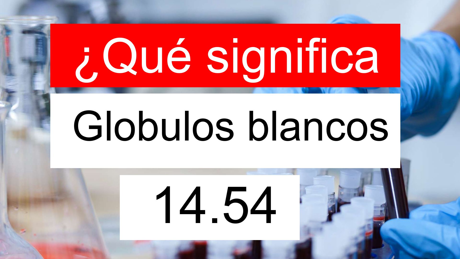 ¿Qué significa Globulos blancos 14.54? ¿La WBC 14,54 es alto, normal, o peligrosa?